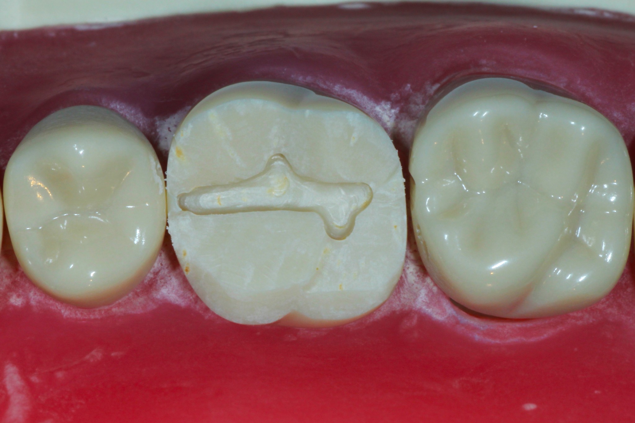 IMG_2329 – International Dentist Central