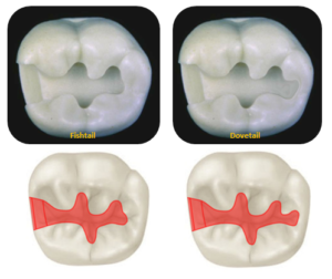 Preparing for UOP – International Dentist Central