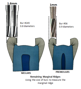 Remaining Marginal Ridge (Mesiodistal Extension) - International ...