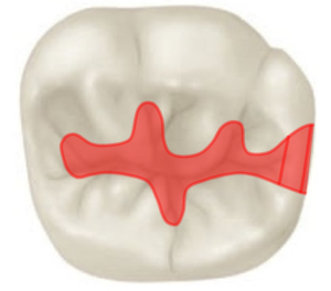 Various Outline Forms – International Dentist Central