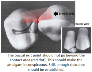 Proximal Box – International Dentist Central