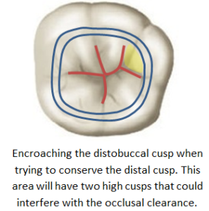 Occlusal View – International Dentist Central
