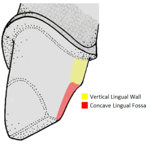 Buccal/Lingual View - International Dentist Central