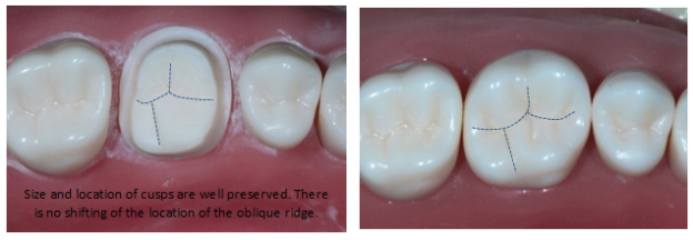 Occlusal View – International Dentist Central